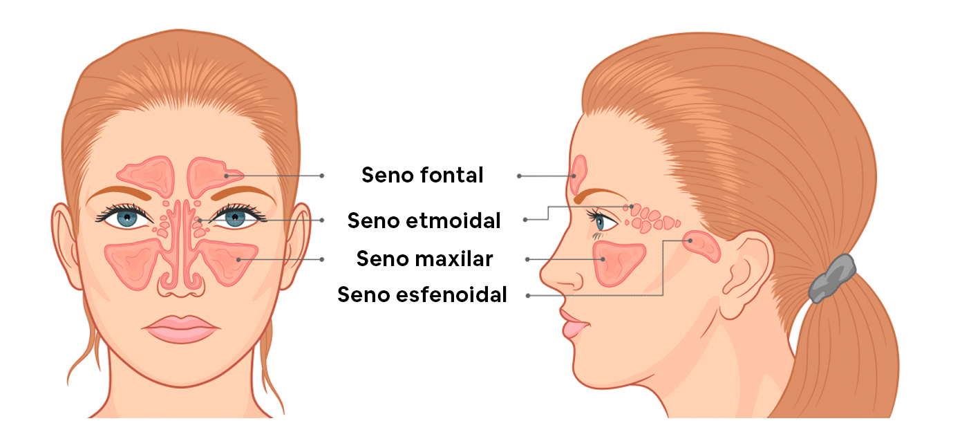 Sinusitis, tipos y síntomas - Doctor Hugo Galera Ruiz
